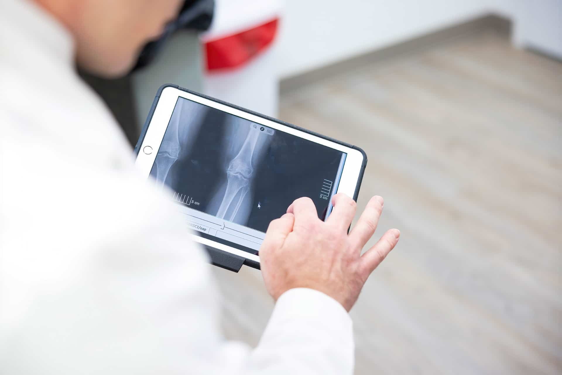 Symptoms of a Torn Meniscus - Princeton Orthopaedic Associates