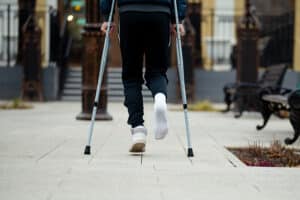 What is The Kidner Procedure - Lasting Foot Pain Relief - Princeton ...