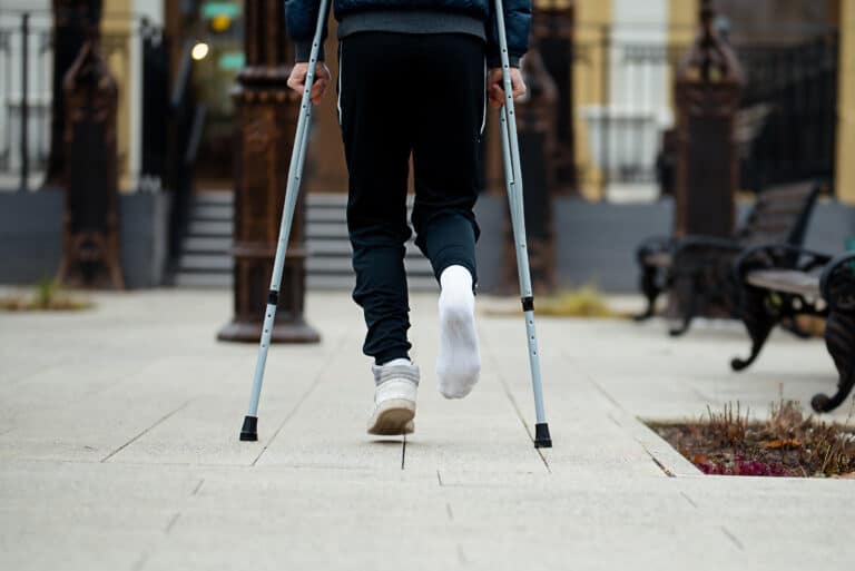 What is The Kidner Procedure - Lasting Foot Pain Relief - Princeton ...