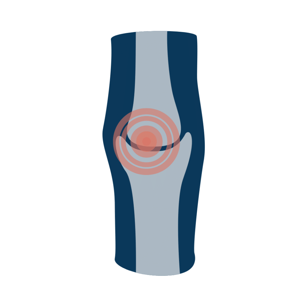 Understanding Bone Spurs Symptoms Causes And Treatments Princeton Orthopaedic Associates