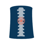 Sprain vs Strain: What’s the difference? - Princeton Orthopaedic Associates