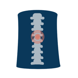 Sprain vs Strain: What’s the difference? - Princeton Orthopaedic Associates