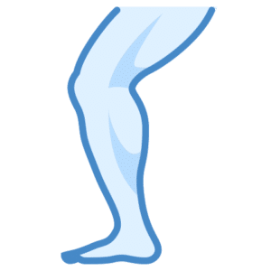 Bowlegged - When The Legs Curve Outward at The Knees - Princeton ...