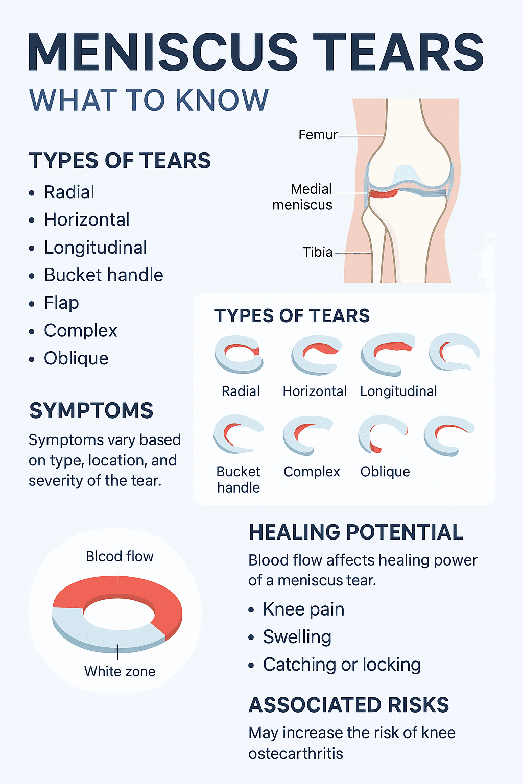 Types of Meniscus Tears - Princeton Orthopaedic Associates